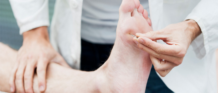 Exploring Chiropractic Peripheral Neuropathy Treatments in Deerfield ...